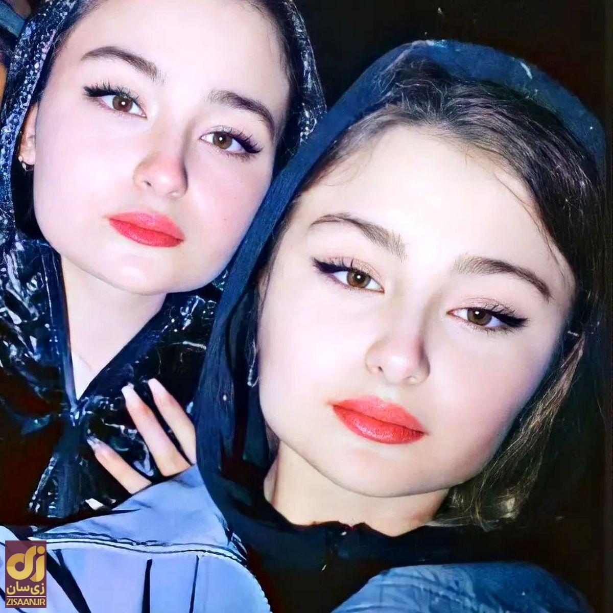 تصاویر تغییر چهره زنانه سارا و نیکا در سوئد دوقلوهای شیرگاهی جای
